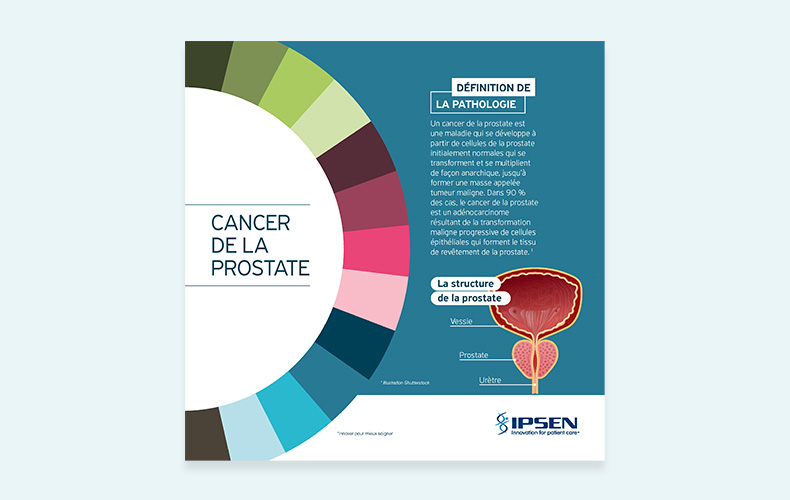 Frise parcours de soins cancer de la prostate - Hello Ipsen